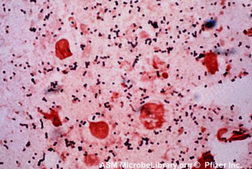 Optical Microscopy: Specimen Preparation, Staining, and Quantitative