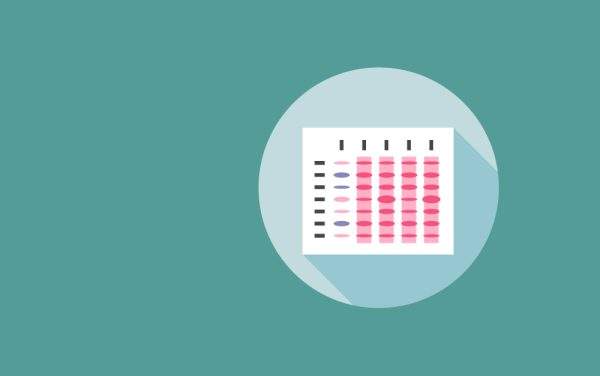 Ponceau S Stain Protocol - Conduct Science